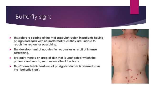Simplification of Dermatology signs.pdf | Skin and Dermatology ...