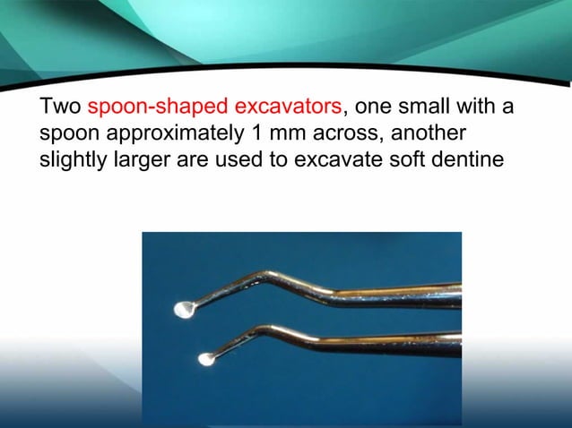 Simplified and modified atraumatic restorative treatment | PPT