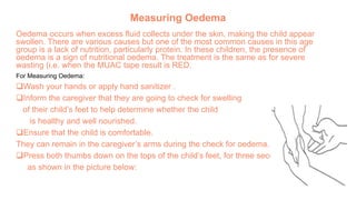 Simplified Approaches for Managment of SAM (2).pptx
