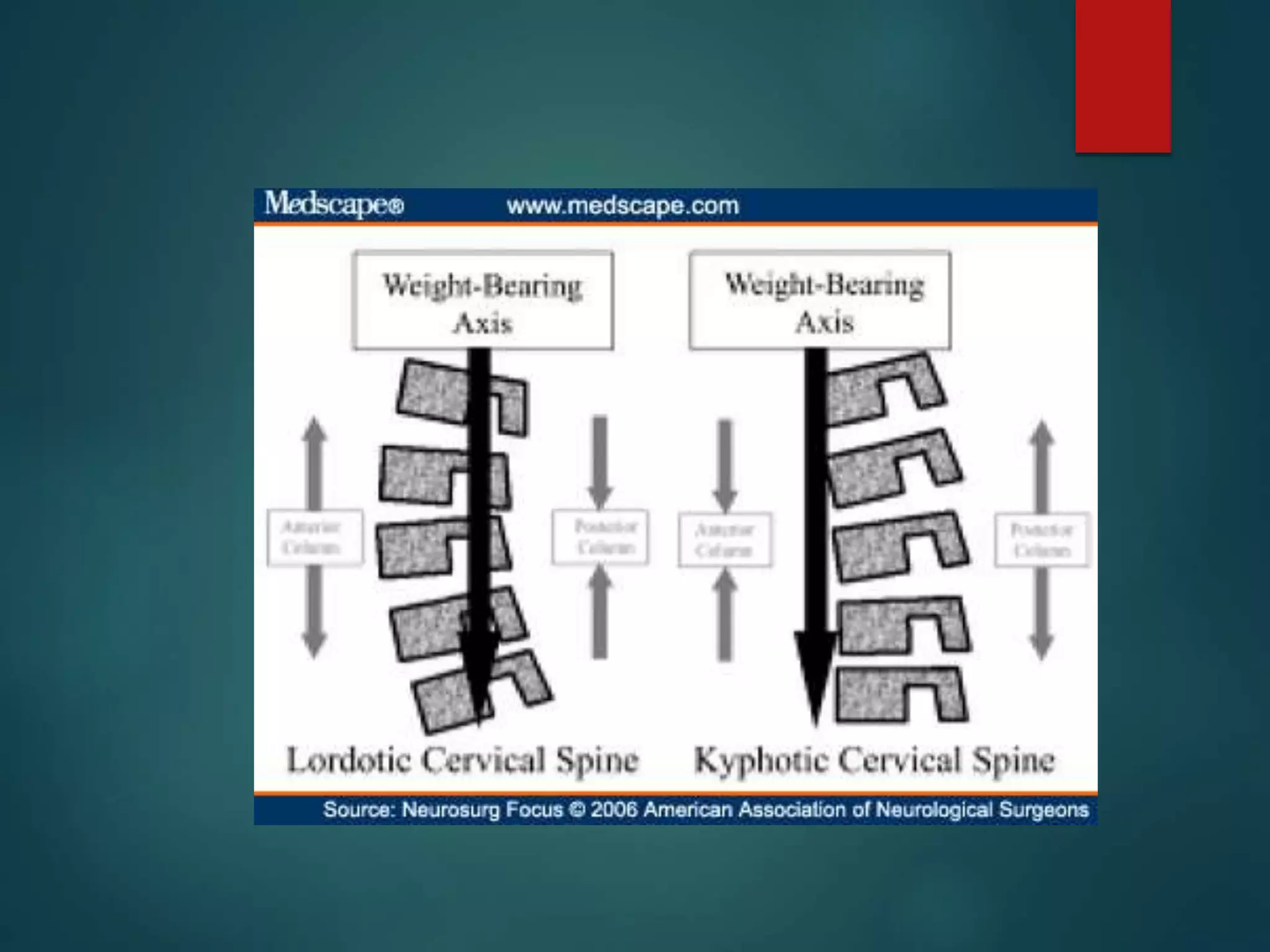 Simplified biomechanics of The Spine.pptx