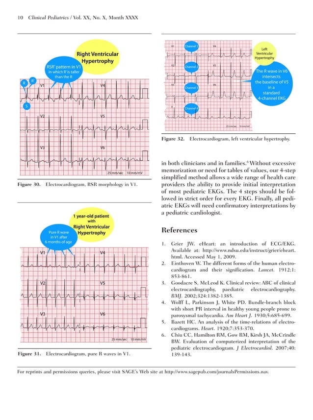 Simplified pediatric electrocardiogram interpretation | PDF