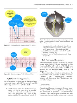 Simplified pediatric electrocardiogram interpretation | PDF
