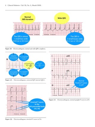 Simplified pediatric electrocardiogram interpretation | PDF