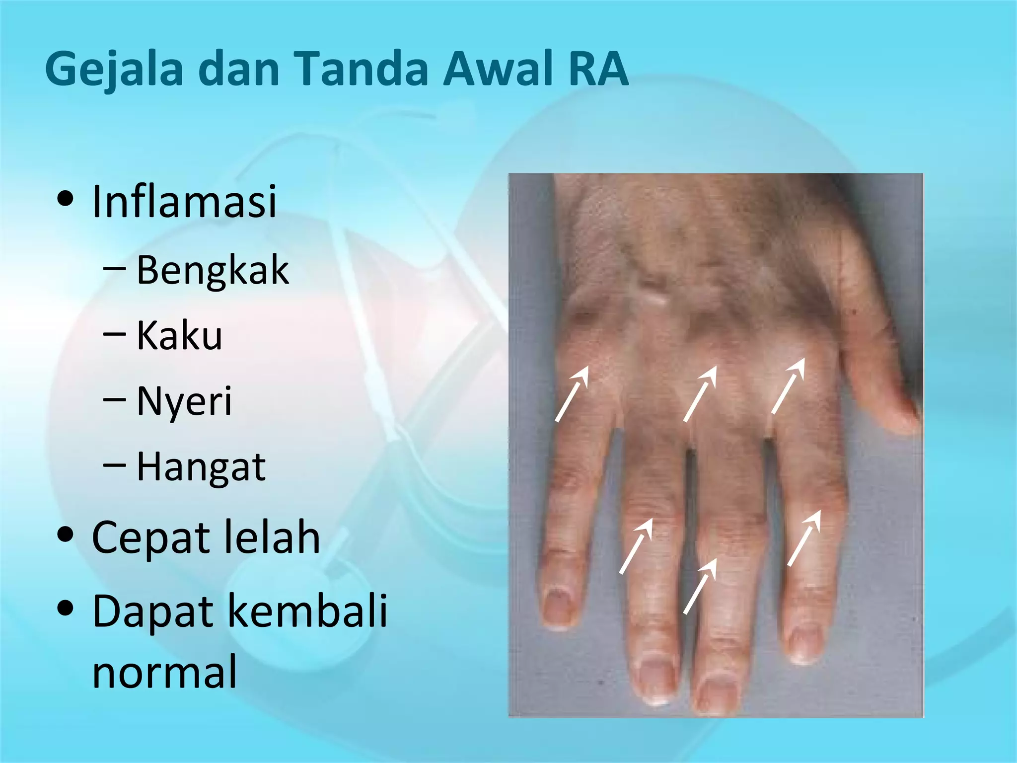Mengenal ragam penyakit Autoimun | PPT