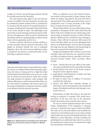 Simpsonâ€™s forensic medicine | PDF