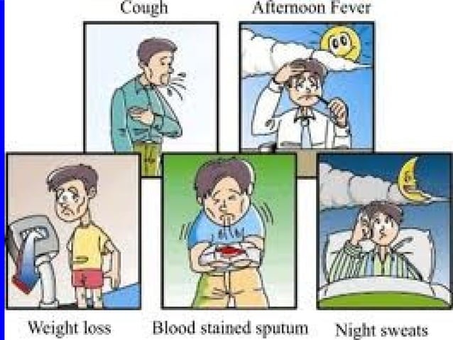Simptomi i klinicki formi na tuberkuloza | PPT