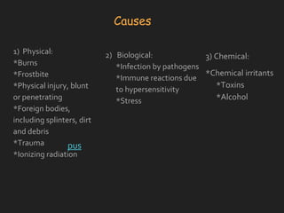 Inflammation- Simran Sonule.pptx