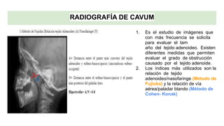 Simulacion imagenes otorrino | PDF