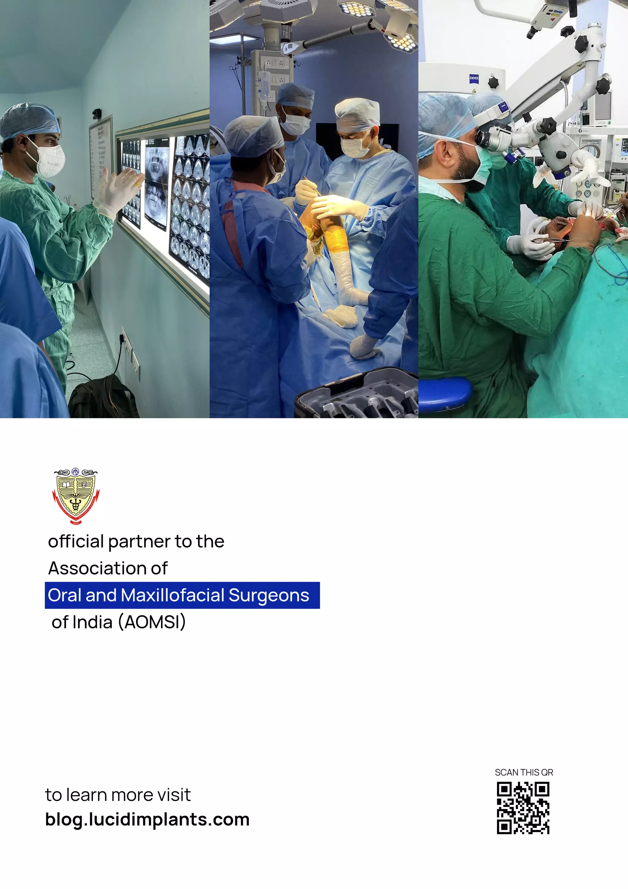 Simulation_Services_LUCID_Implants | PDF