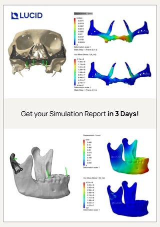 Simulation_Services_LUCID_Implants | PDF
