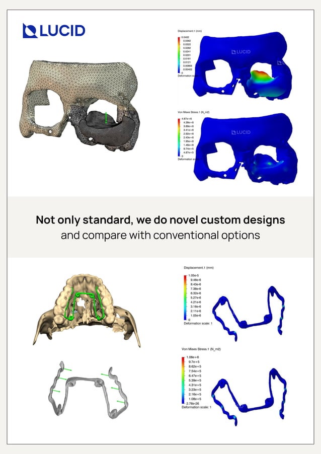 Simulation_Services_LUCID_Implants | PDF