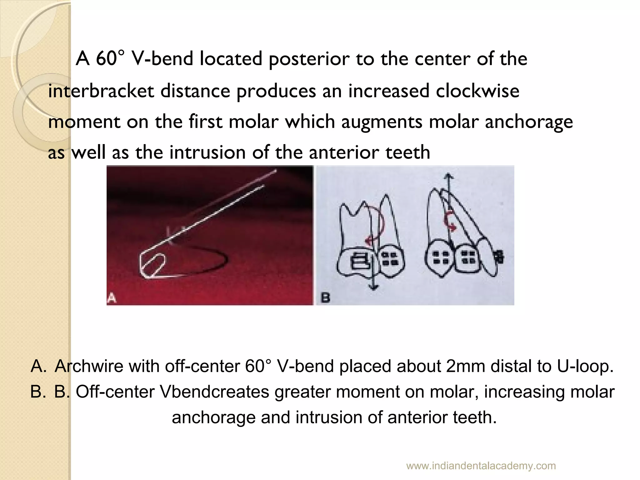 Simultaneous intrusion and retraction of the anterior teeth | PPT