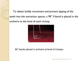 Simultaneous intrusion and retraction of the anterior teeth | PPT