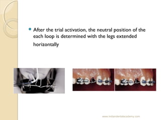 Simultaneous intrusion and retraction of the anterior teeth | PPT