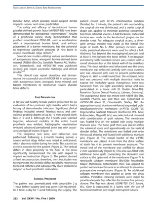 Simultaneous vertical guided bone regeneration and guided tissue ...