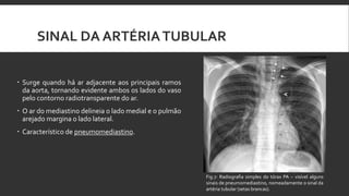 Sinais_clássicos_em_radiologia_do_tórax.pdf