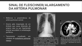 Sinais_clássicos_em_radiologia_do_tórax.pdf