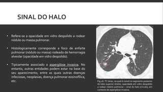 Sinais_clássicos_em_radiologia_do_tórax.pdf