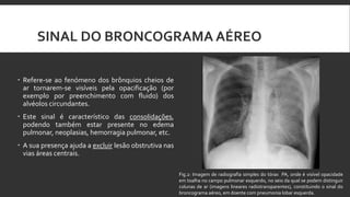 Sinais_clássicos_em_radiologia_do_tórax.pdf