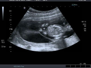 Si̇nan beksaç | PDF