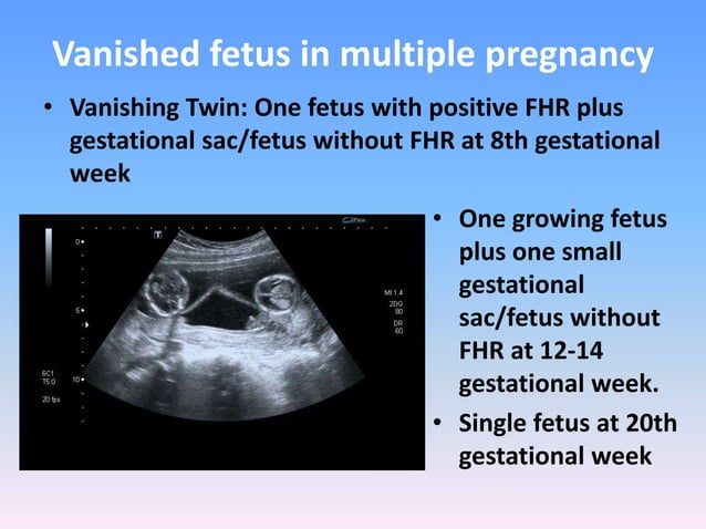 Si̇nan beksaç | PPT