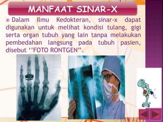 Sinar x dan sinar tampak | PPTX
