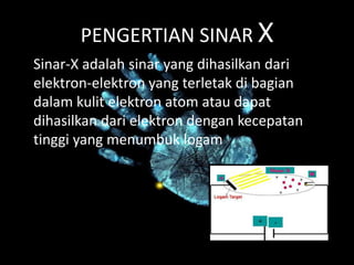 Sinar gamma dan sinar x | PPTX