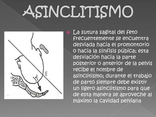 Sinclitismo y asinclitismo | PPTX