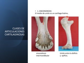 Sindesmologa | PPTX