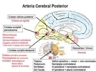 SINDROME VERTEBROBASILAR | PPTX