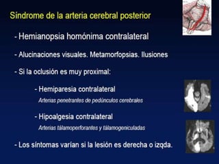 SINDROME VERTEBROBASILAR | PPTX