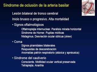 SINDROME VERTEBROBASILAR | PPTX
