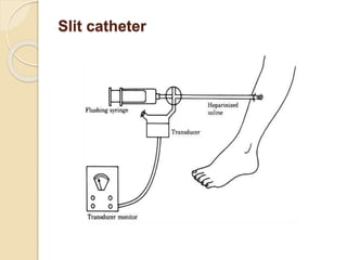 SIndreom K.pptx | Free Download