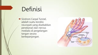 Sindrom Carpal Tunnel.pptx