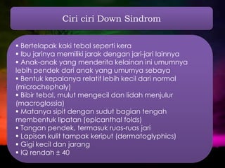 Down Sindrom | PPTX