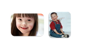 Down Sindrom PPT | PPTX