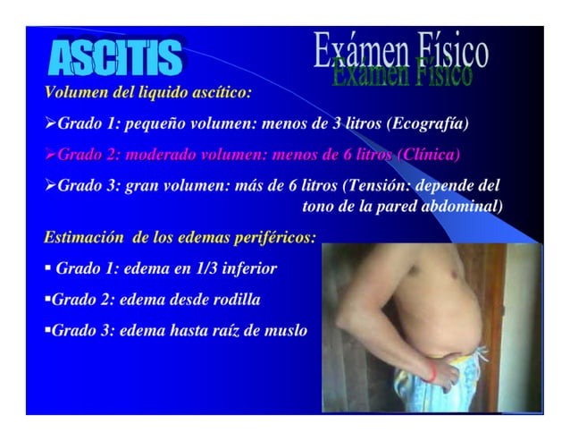 Sindrome Ascitico Edematoso | PPT
