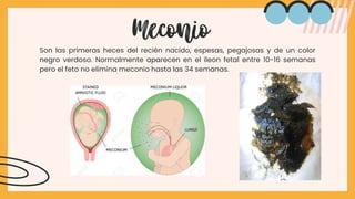 sindrome-de-aspiracion-de-meconio (2).pdf