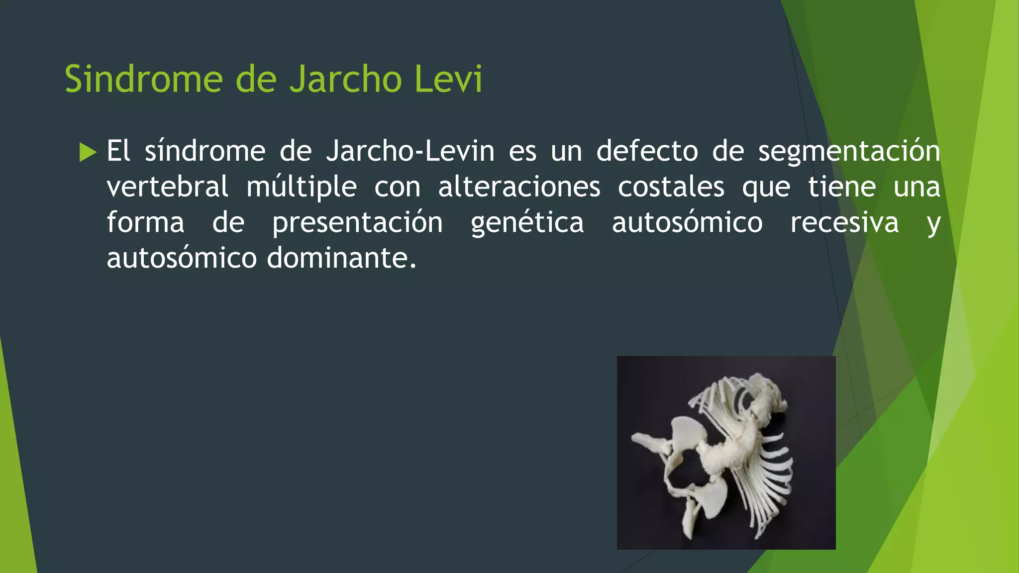 Sindrome de-jarcho-levi (1)