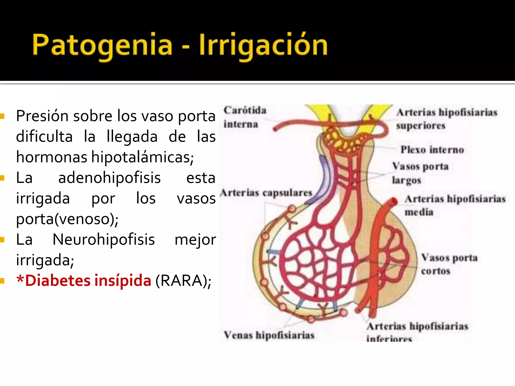 Sindrome de la silla turca vacia | PPTX