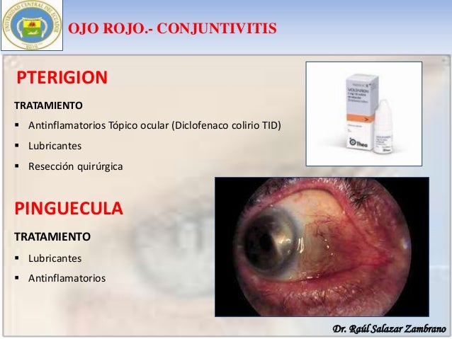 Sindrome de-ojo-rojo-optometria