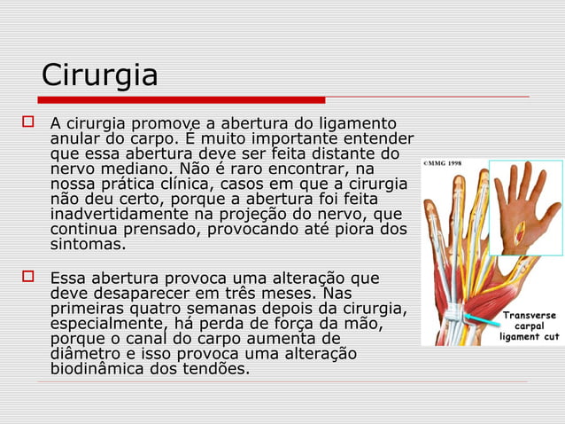 Sindrome-do-tunel-do-carpo | PPT