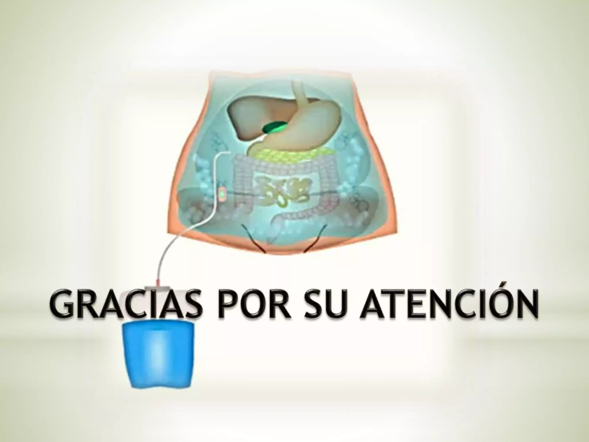 SINDROME ASCITICO.pptx