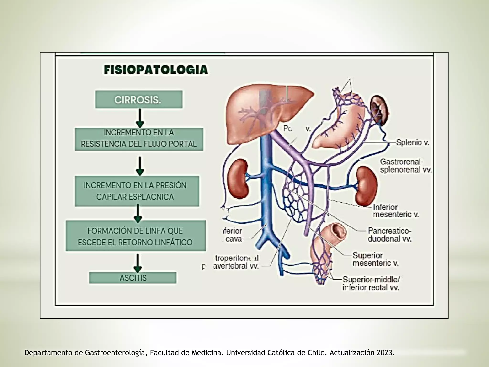 SINDROME ASCITICO.pptx