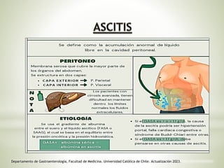 SINDROME ASCITICO.pptx