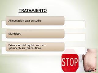 SINDROME ASCITICO.pptx