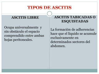 Semiologia Medica- Sindrome ascitico | PPTX
