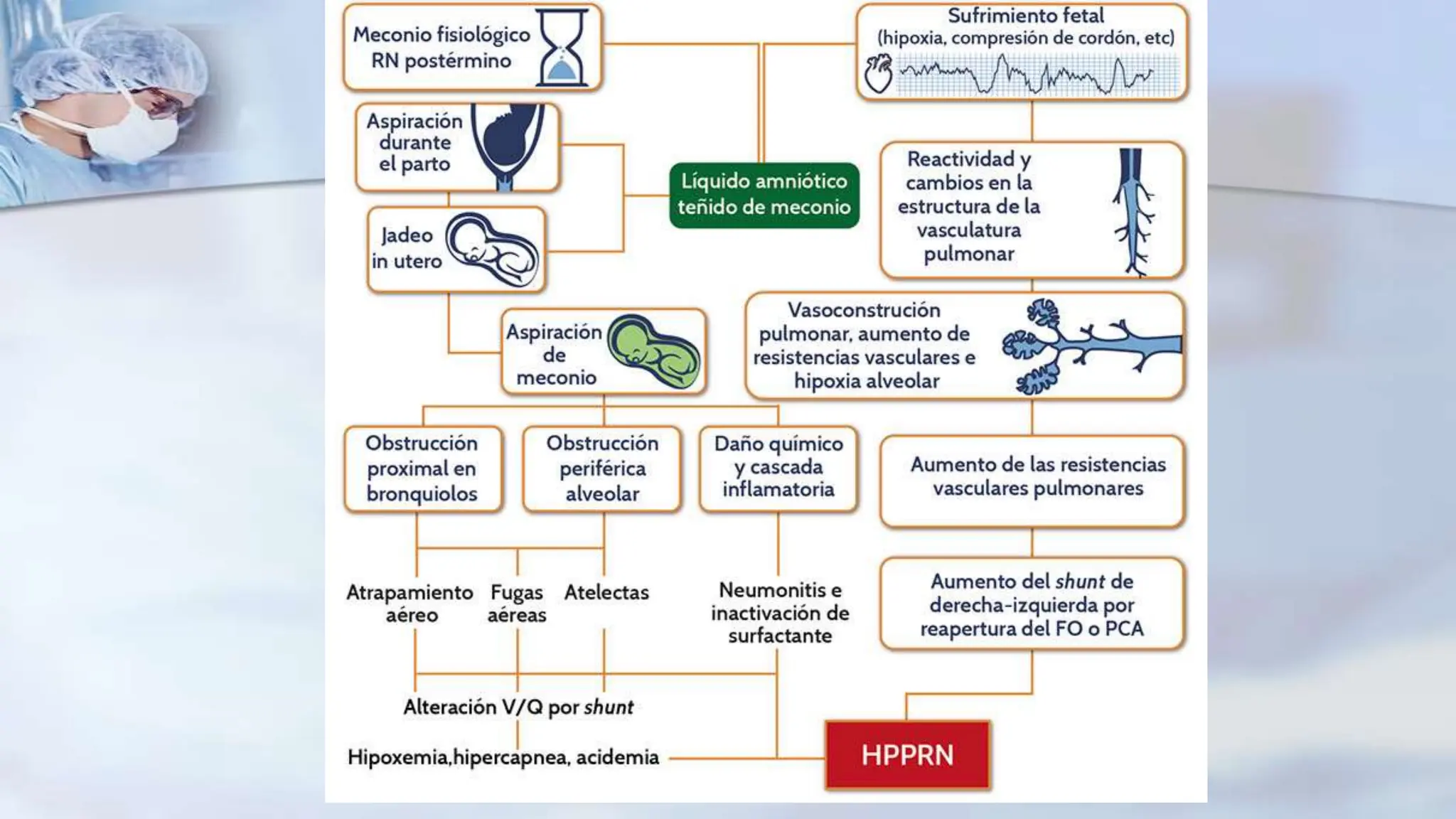 SINDROME ASPIRACION DE MECONIO EN NEONATOS | PPT