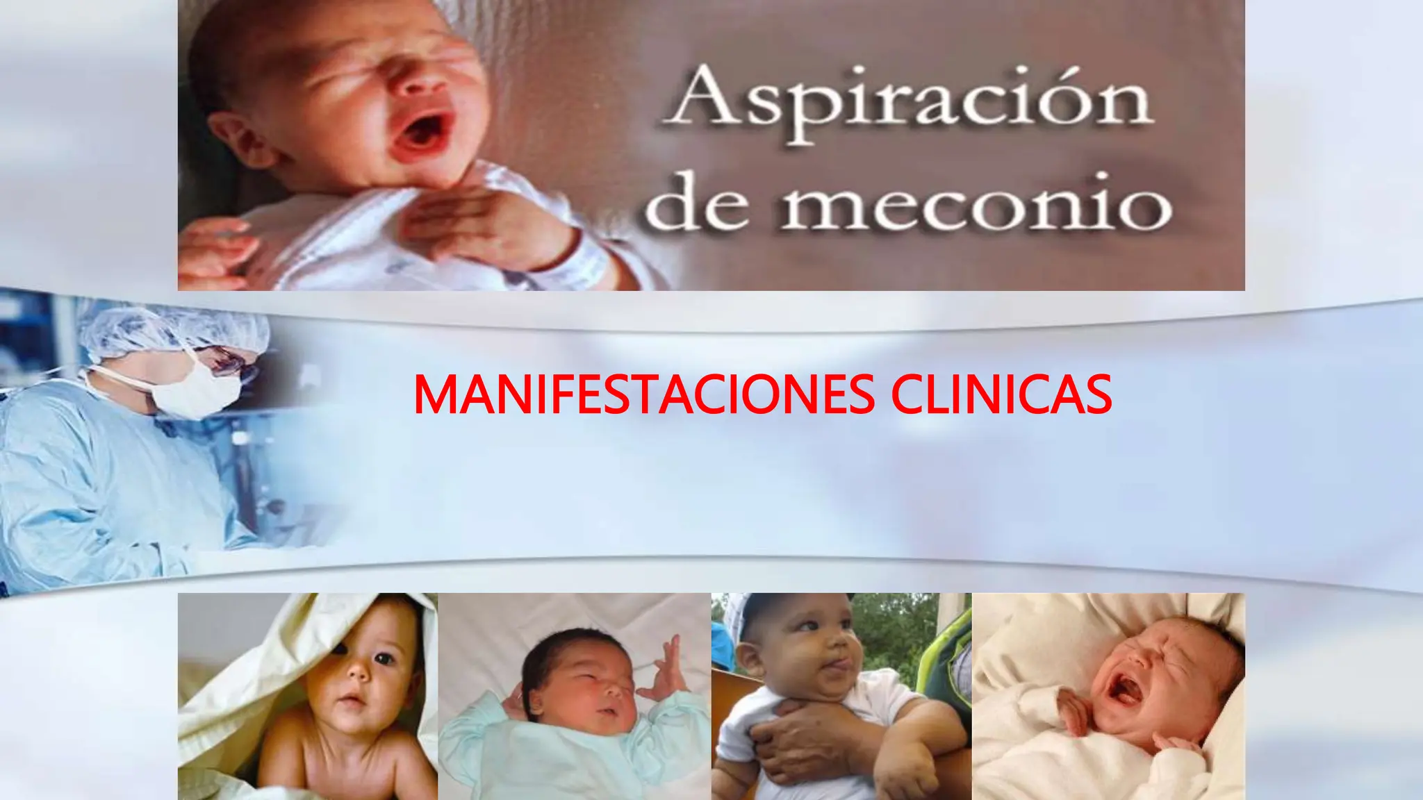SINDROME ASPIRACION DE MECONIO EN NEONATOS | PPT