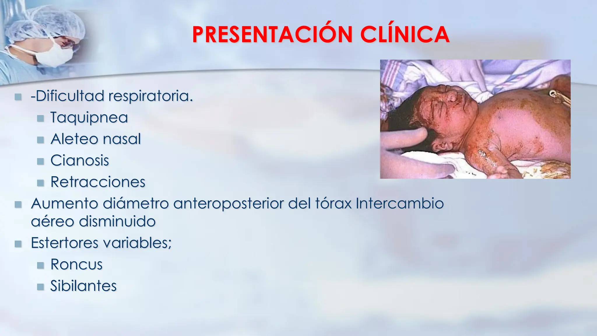 SINDROME ASPIRACION DE MECONIO EN RECIEN NACIDO POSTERMINO | PDF